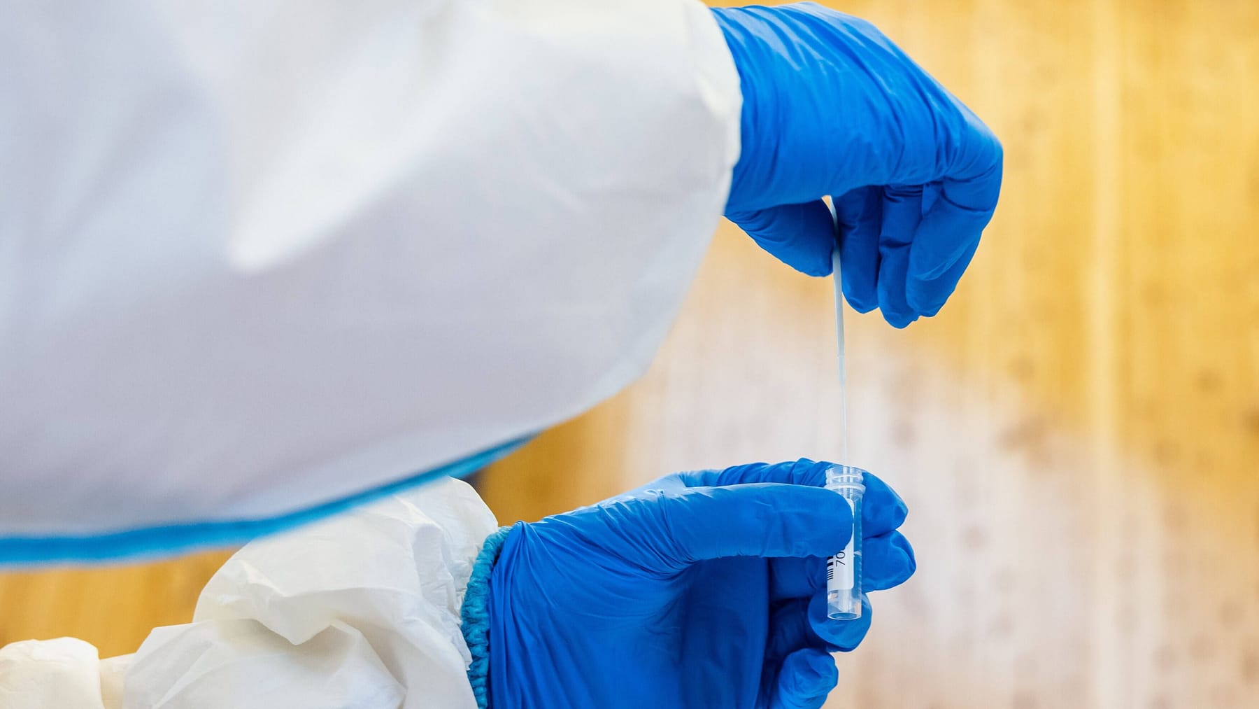 Neue Corona-Variante XBB.1.5: WHO meldet steigende Zahlen in Europa